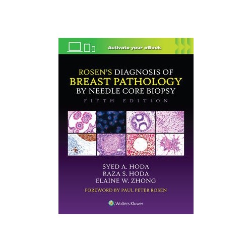 Rosen`s Diagnosis of Breast Pathology by Needle Core Biopsy - NOBEL ...